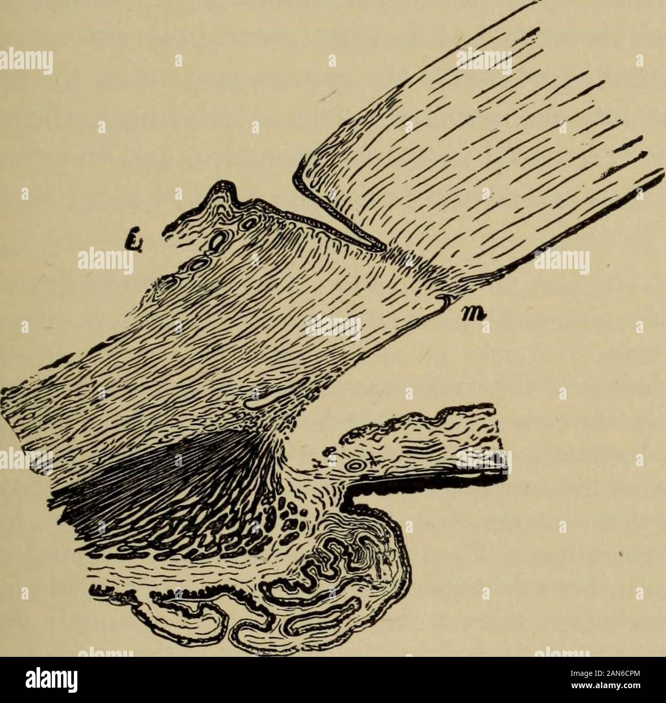 Incised wound hi-res stock photography and images - Alamy