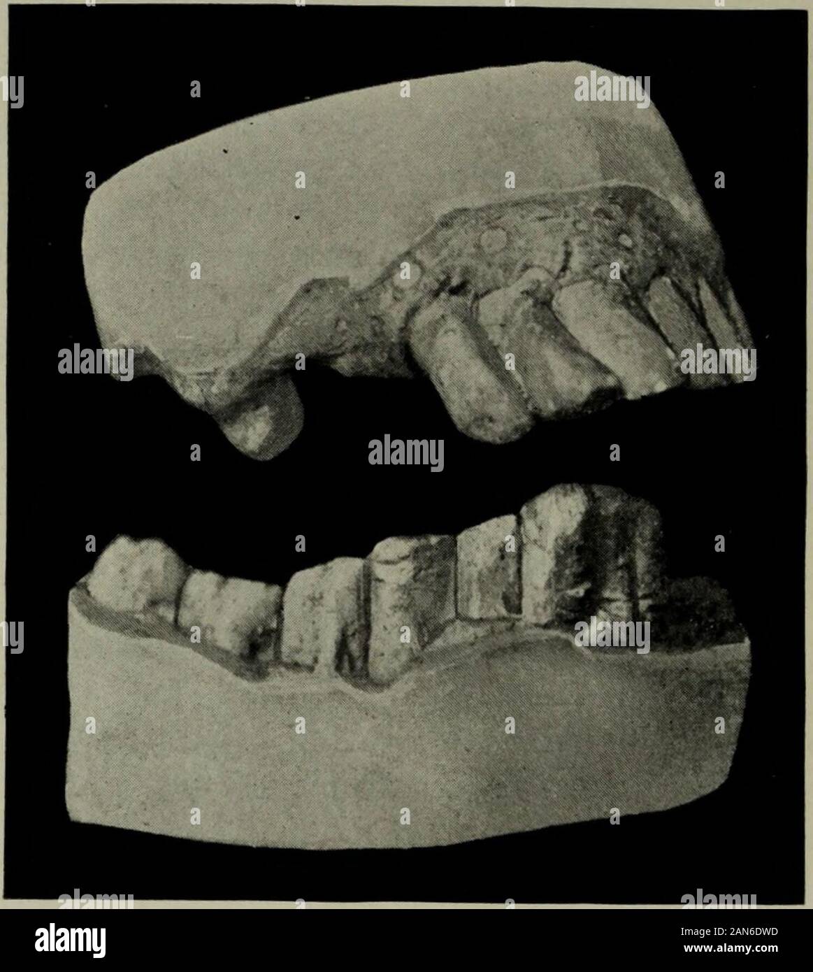 The Dental cosmos . dge work Ialways follow—and filling the canal ofthe ...