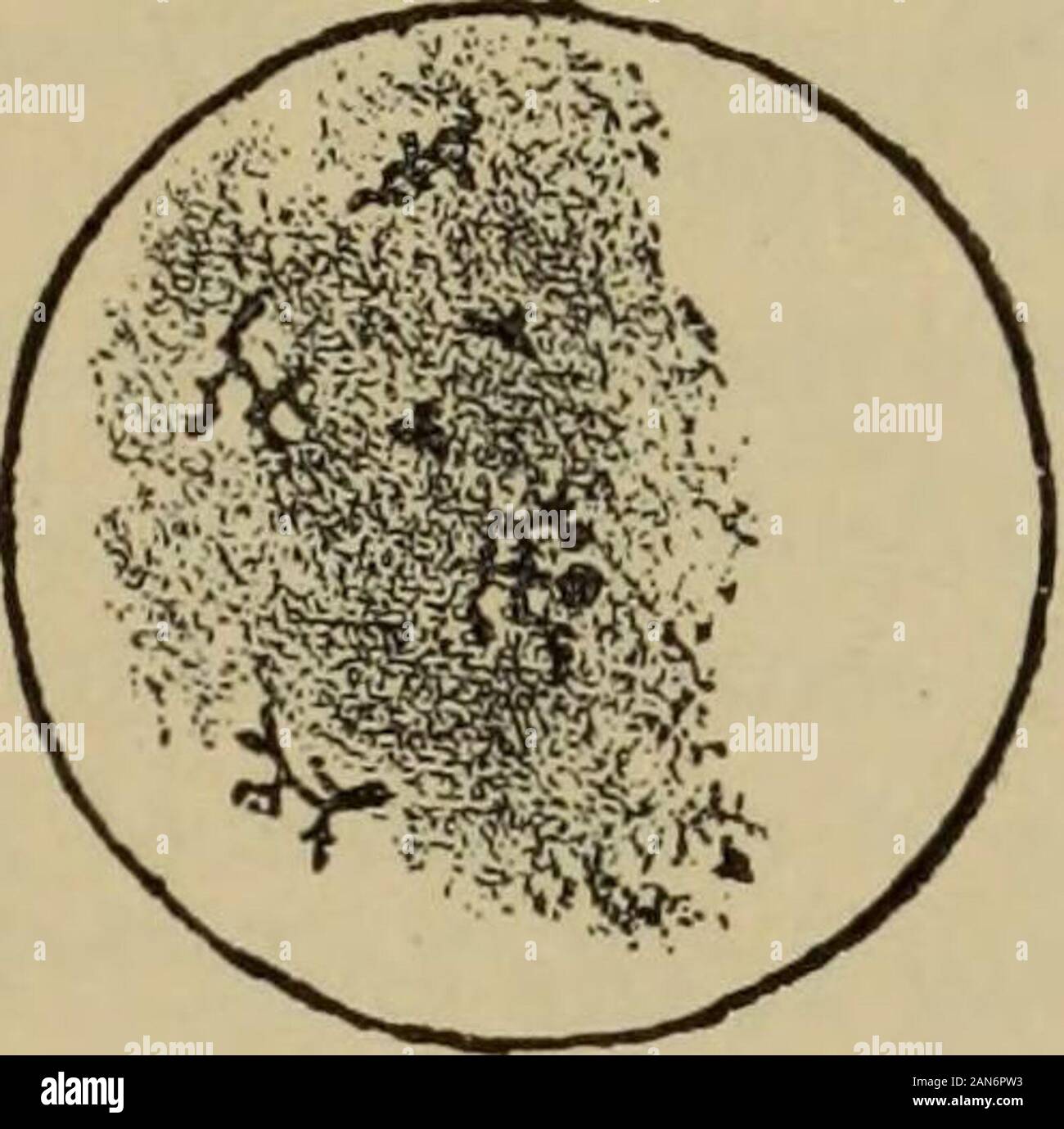 Text-book of ophthalmology . ABC Fig. 94.—Forms of Ulcer that Develop ...