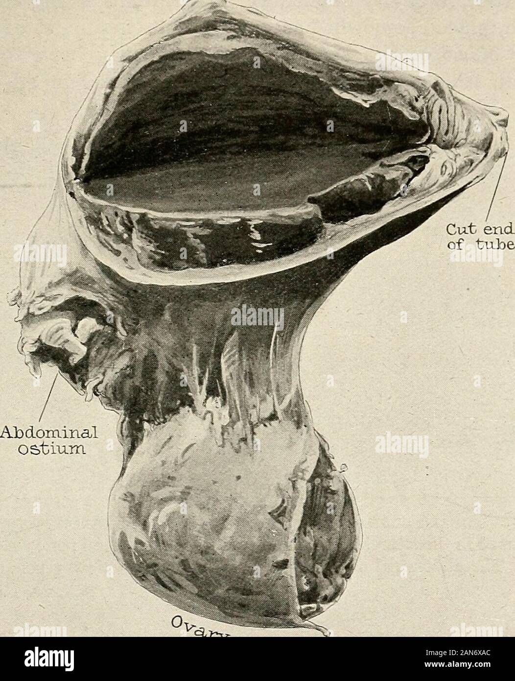 Fallopian tube section hi-res stock photography and images - Alamy