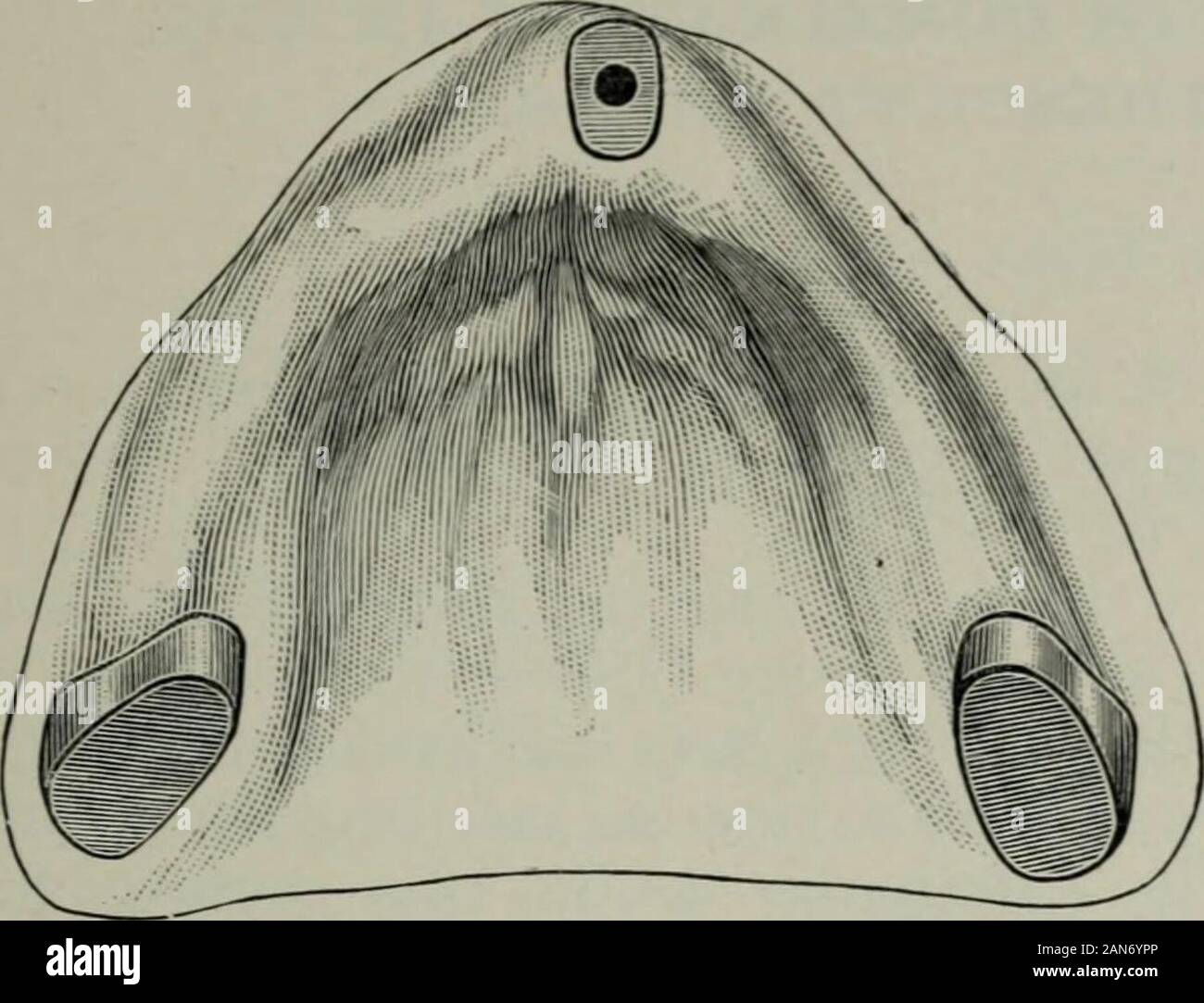 Tube insert in mouth hi-res stock photography and images - Alamy