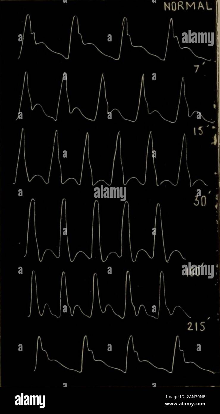 Sodium nitrite hi-res stock photography and images - Alamy