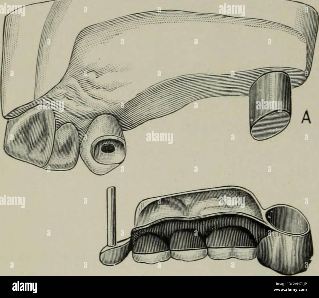 The Dental cosmos . Completed piece on cast. them together, using 20-k ...