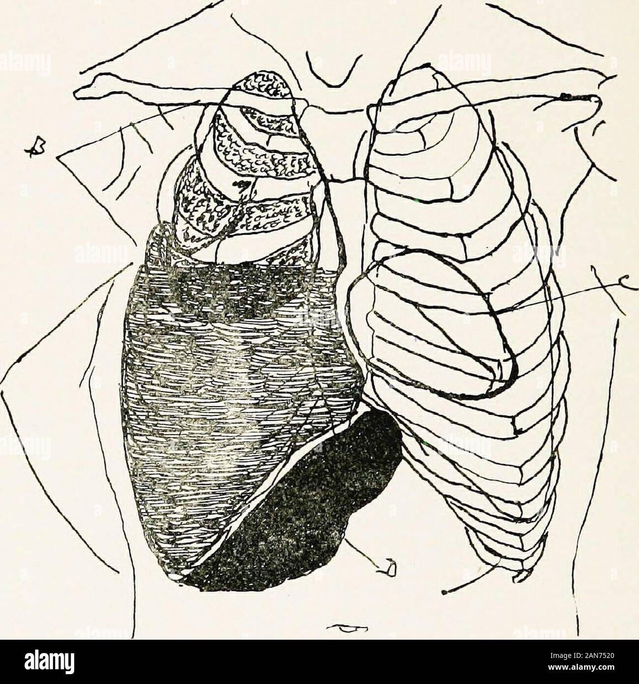The signs of internal disease, with a brief consideration of the ...
