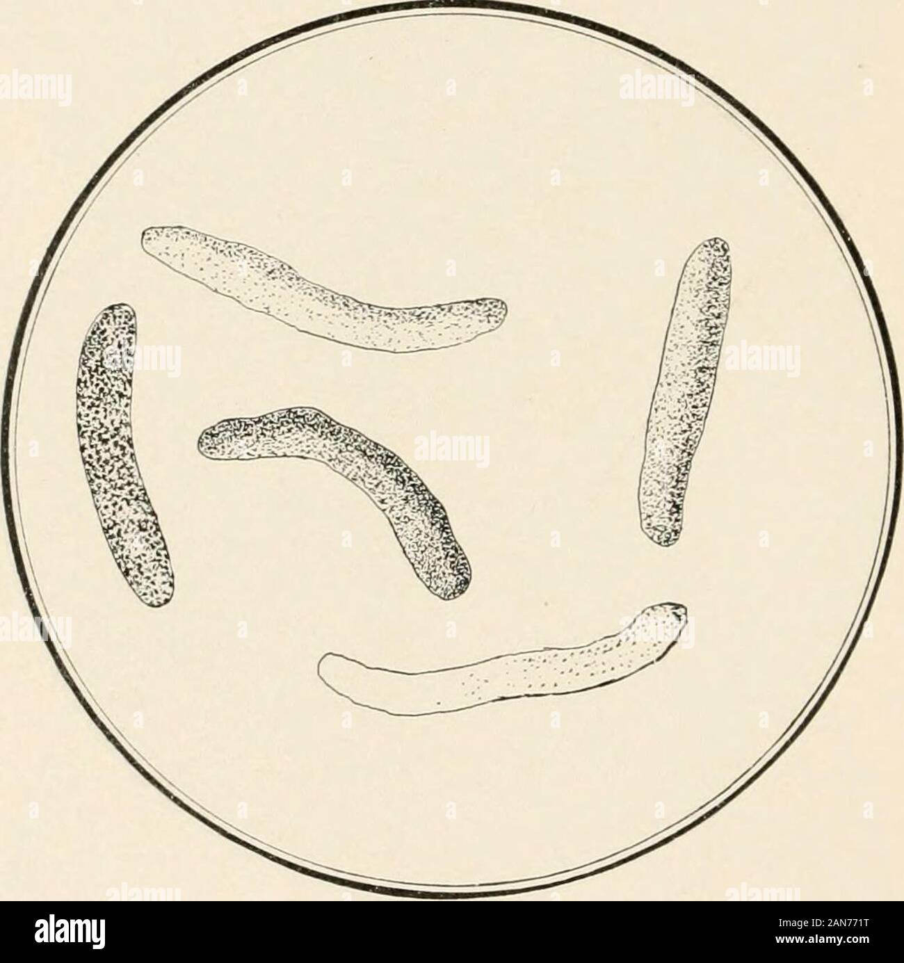 Ranular hi-res stock photography and images - Alamy