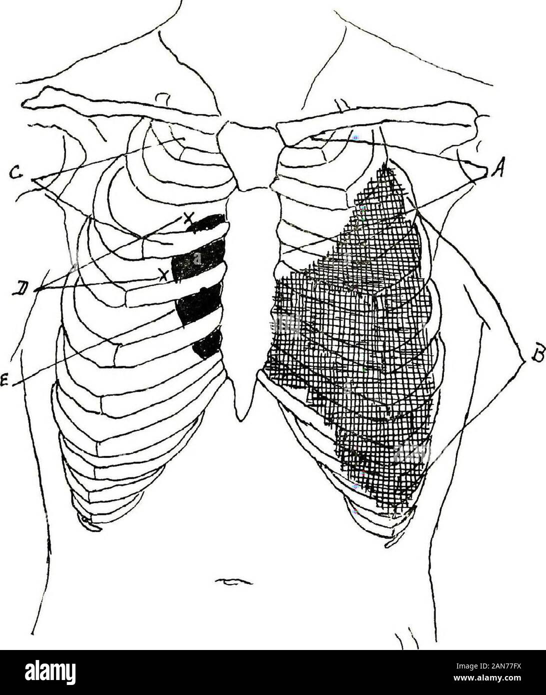 The signs of internal disease, with a brief consideration of the ...