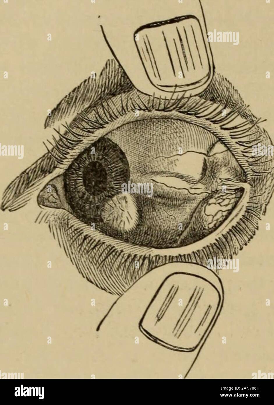Text-book of ophthalmology . es the cutis and, like the latter ...
