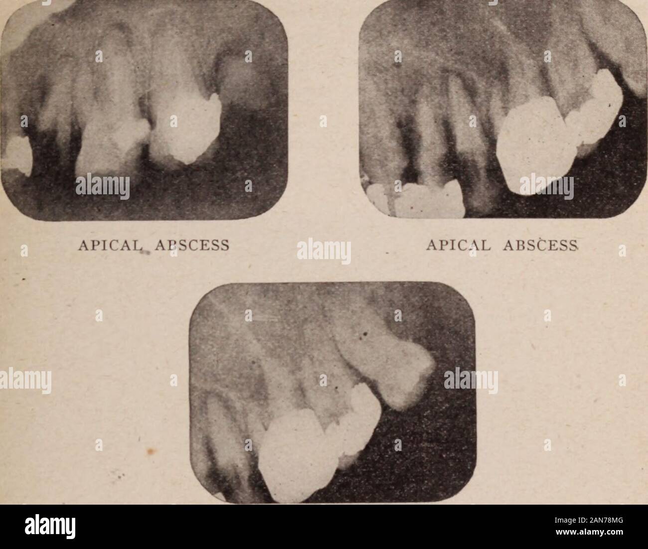 Pulp stones hi-res stock photography and images - Alamy