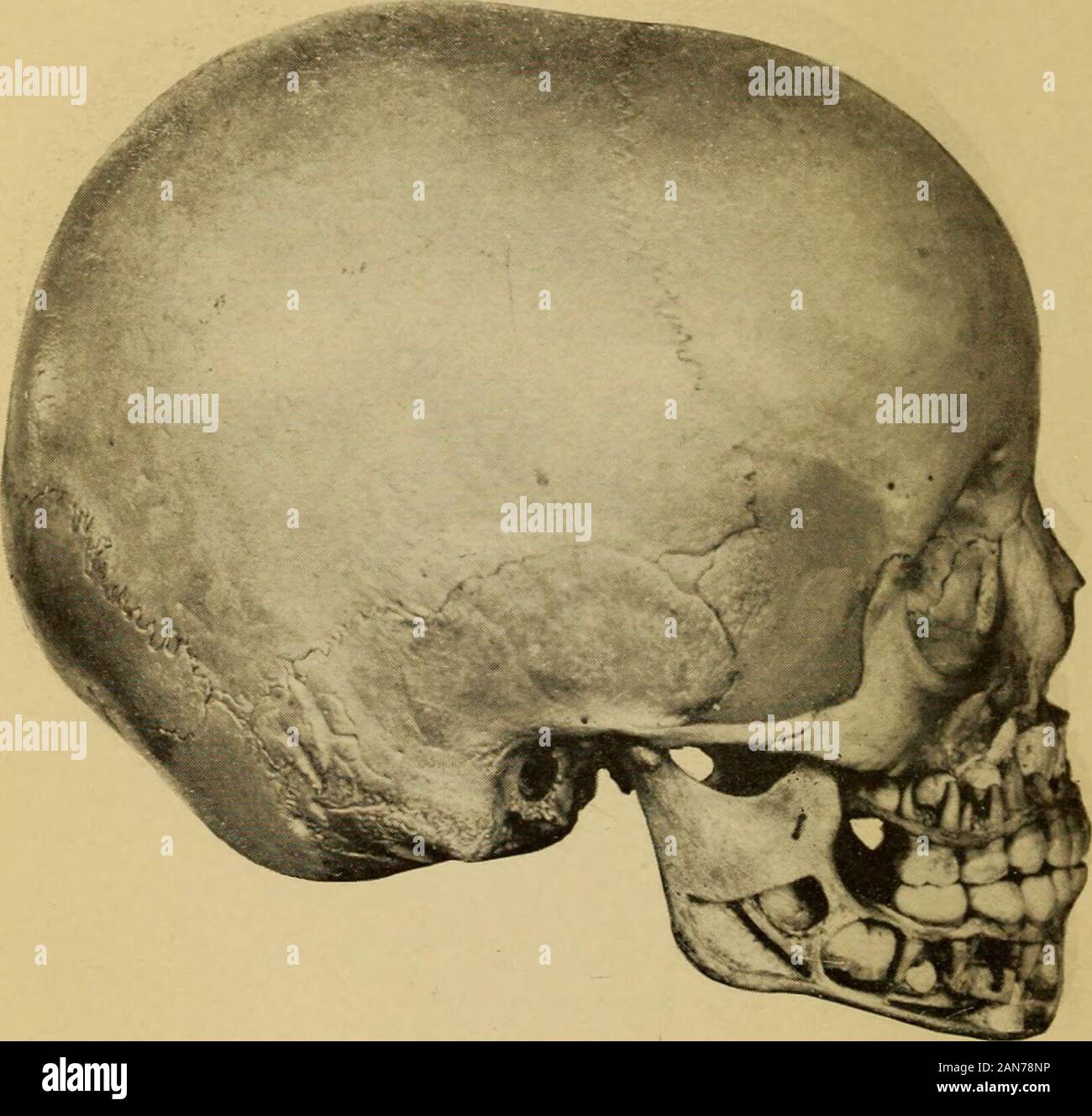 Mouth hygiene and mouth sepsis . Head of Child, aged 3 2 to 4 Years ...