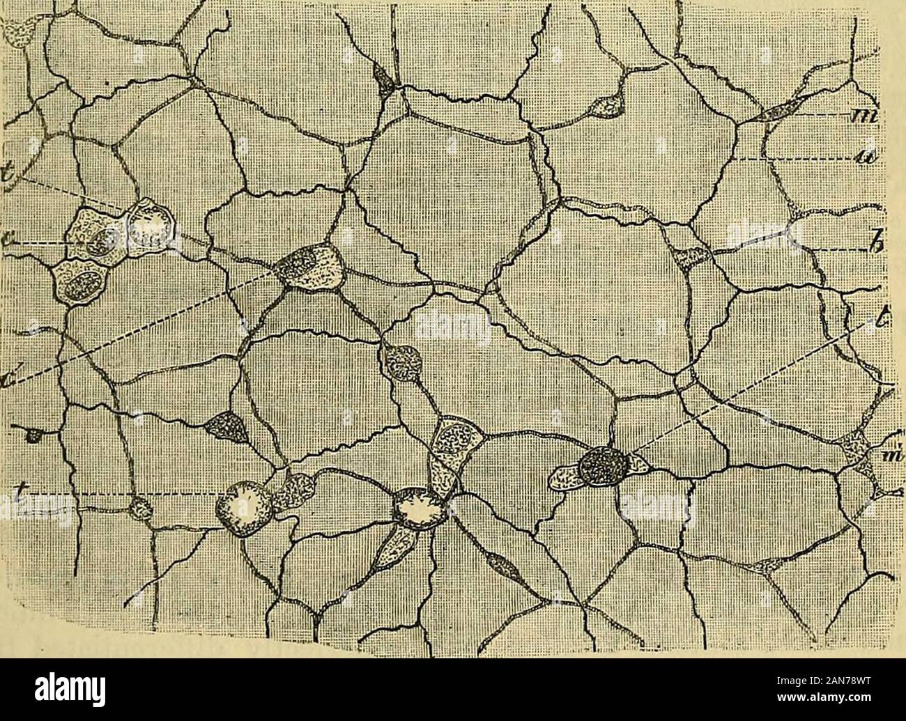 Adenoid tissue hi-res stock photography and images - Alamy