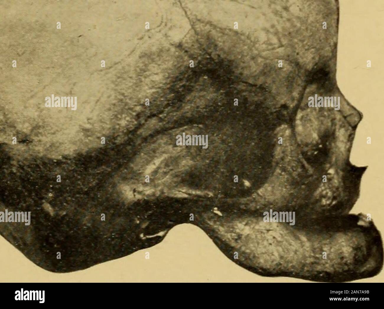 Mouth hygiene and mouth sepsis . Head of Infant, Front View, showing ...