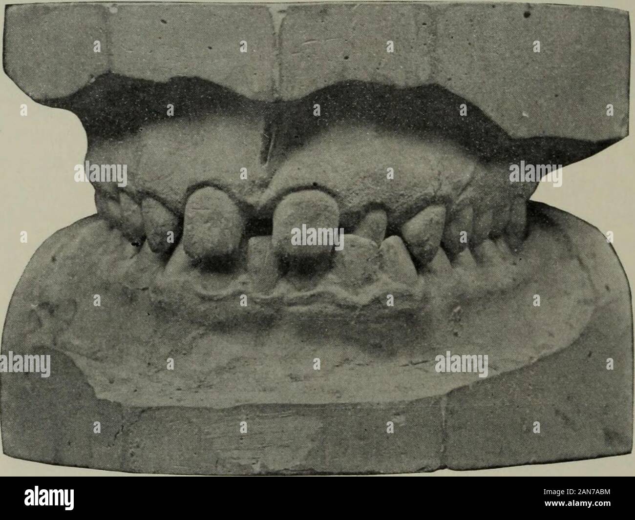 The Dental cosmos . side. I found also that the muscles of the month ...