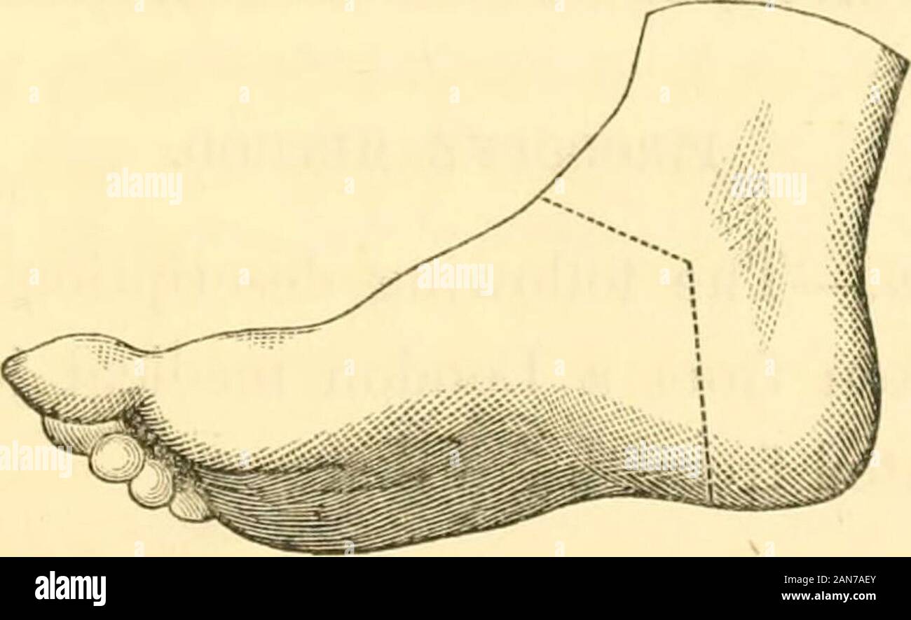 Os calcis hi-res stock photography and images - Alamy