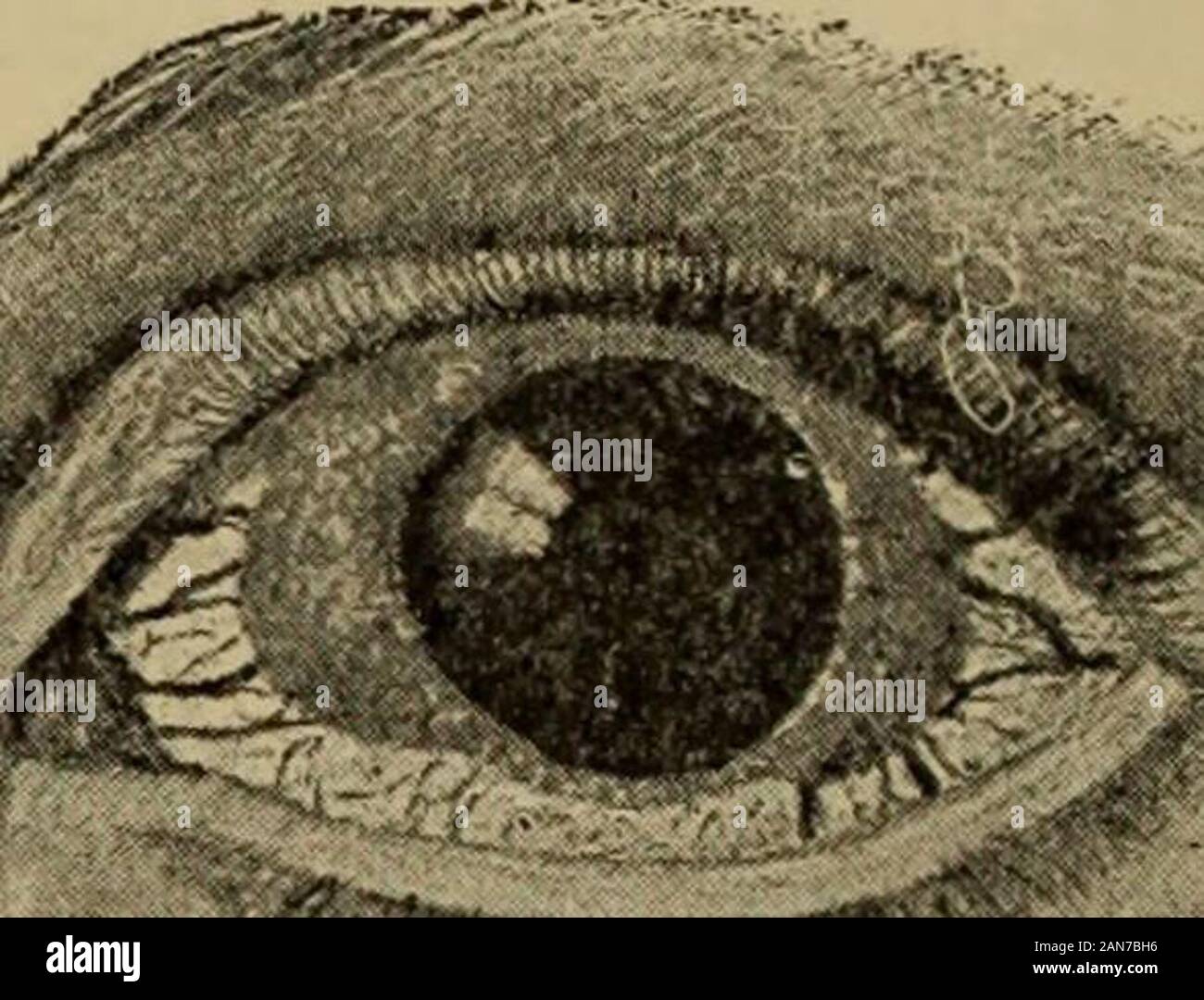 Text-book of ophthalmology . f&. Fig. 57. Fig. 58. Fig. 57.—Spring ...