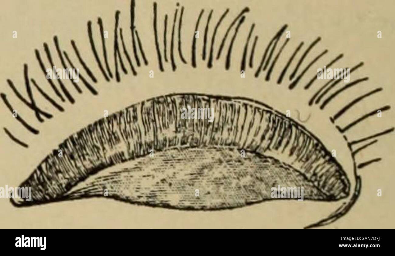 Meibomian glands hi-res stock photography and images - Alamy