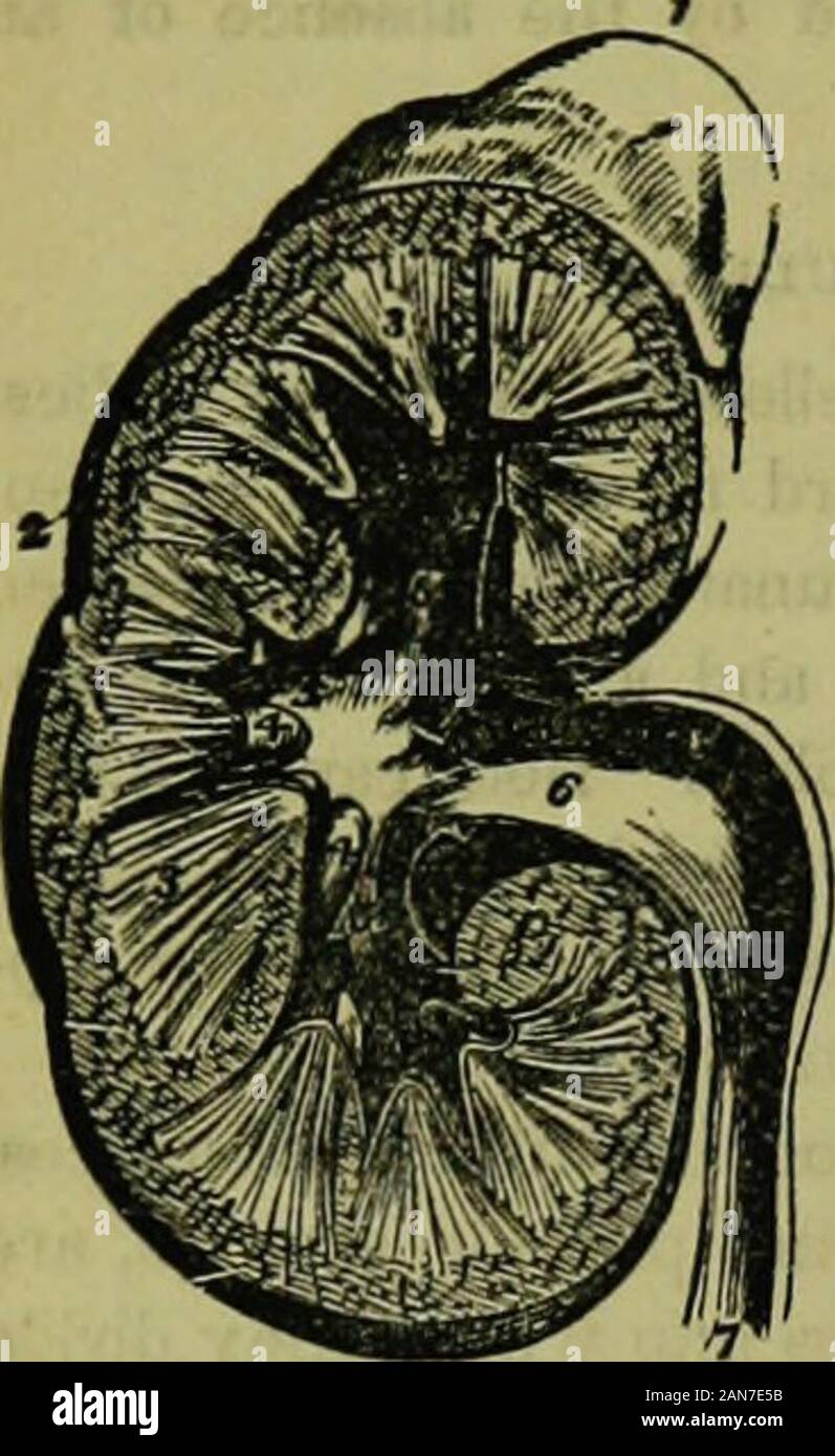 The hydropathic encyclopedia: a system of hydropathy and hygiene ...