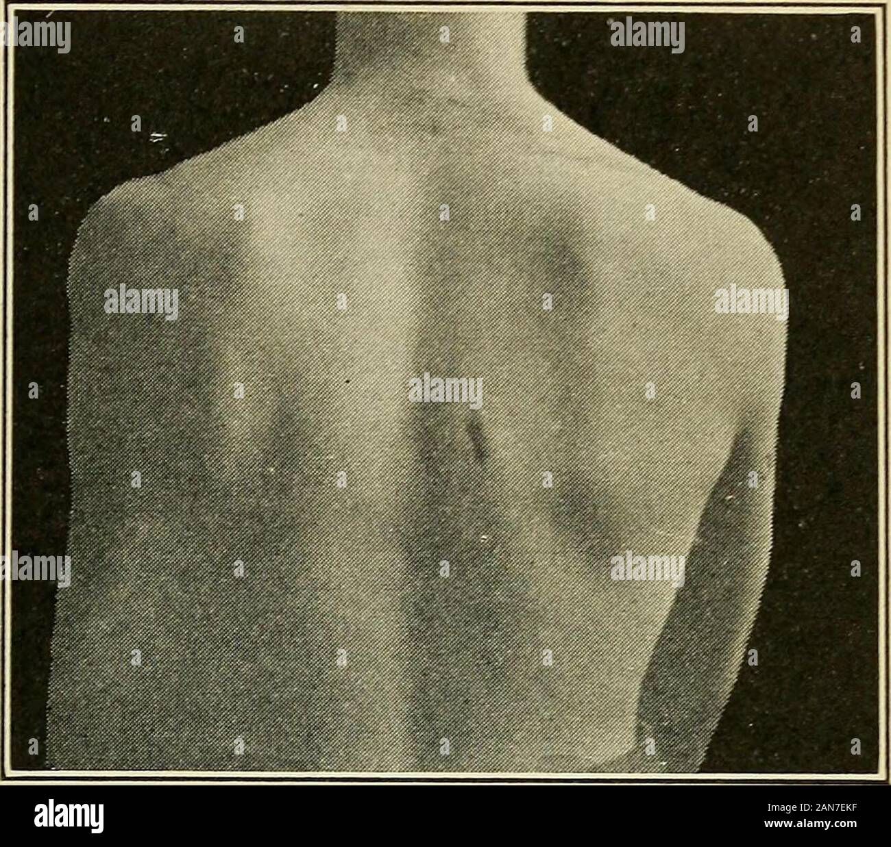 Reclaiming the maimed; a handbook of physical therapy . Fig. I ...