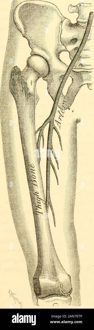 Groin wounds hi-res stock photography and images - Alamy