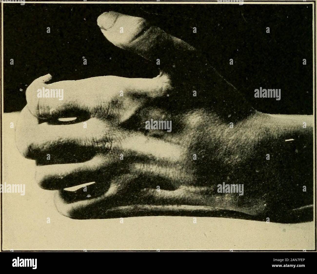 Activemovement hi-res stock photography and images - Alamy