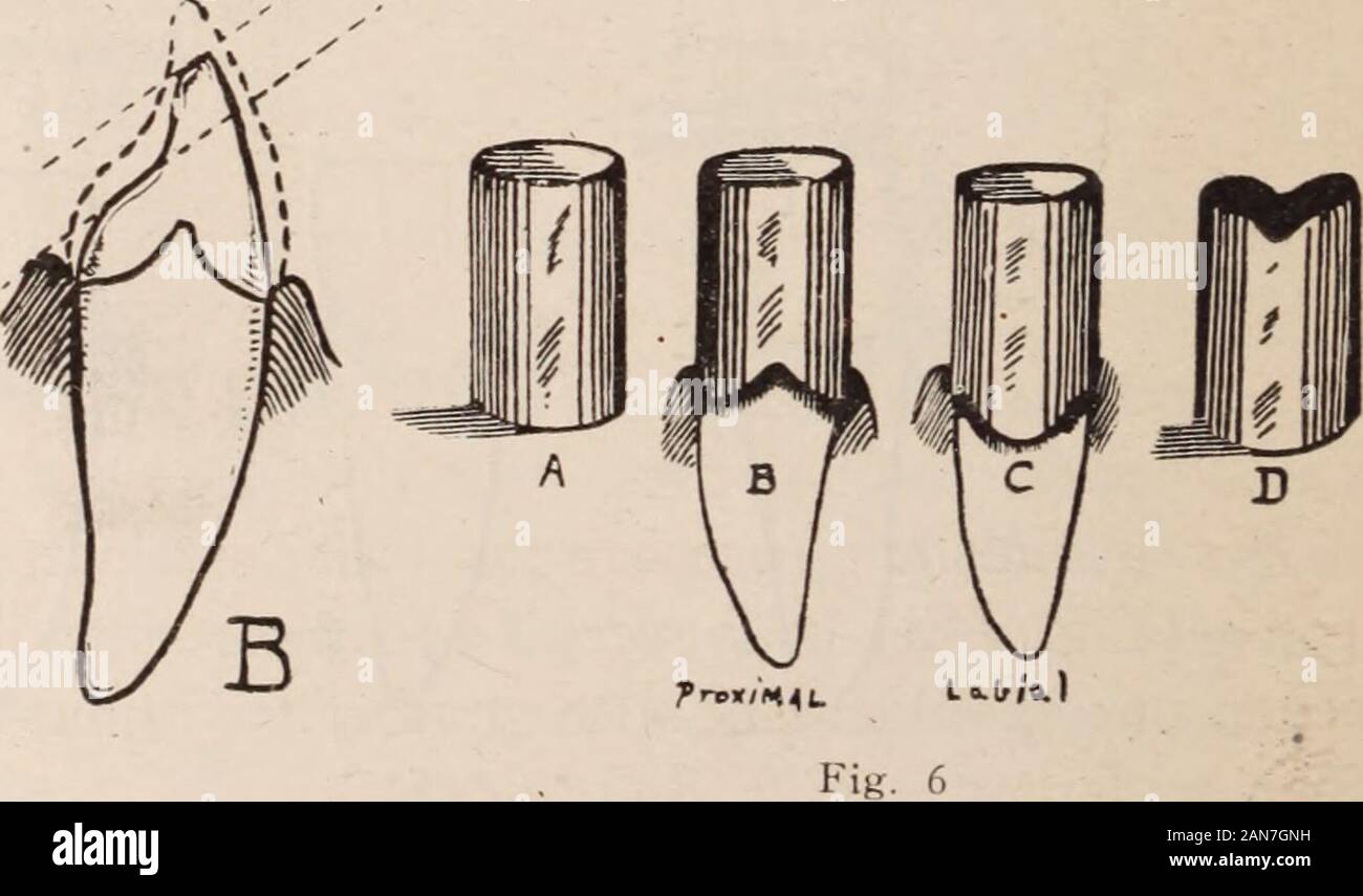 Dental review; devoted to the advancement of dentistry. . Fig.. of a ...