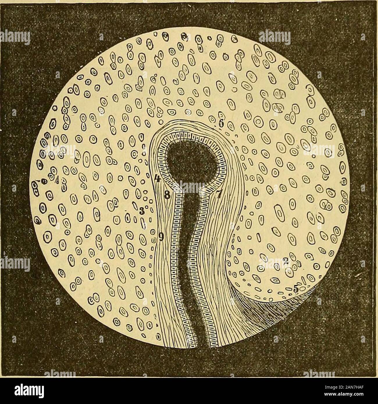 Salpingo hi-res stock photography and images - Alamy