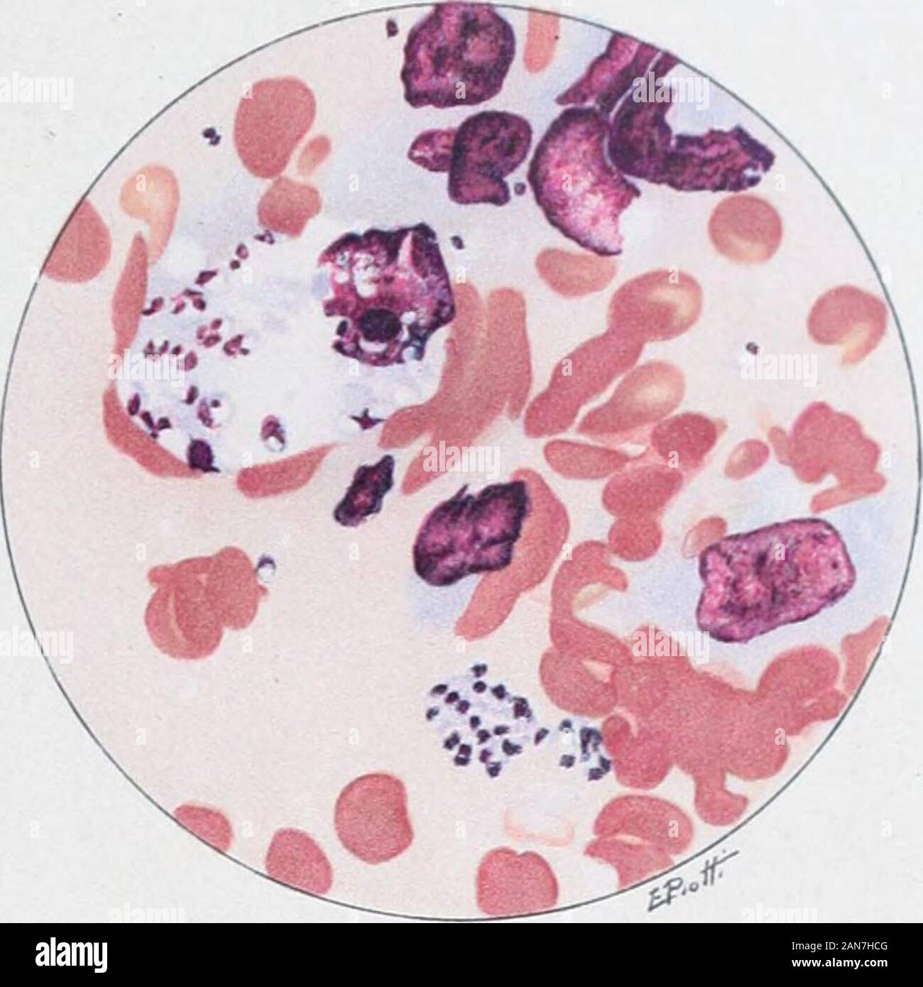 Leishmania dog hi-res stock photography and images - Alamy