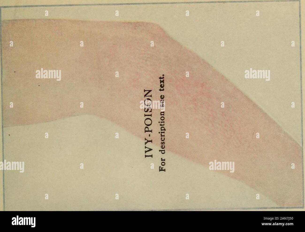 Rash hours hi-res stock photography and images - Alamy