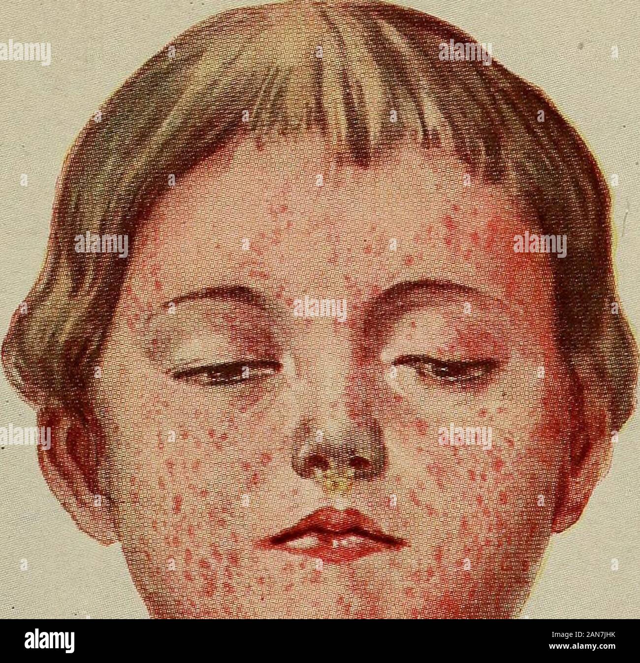 The health-care of the growing child; . to bed at least until thefever ...