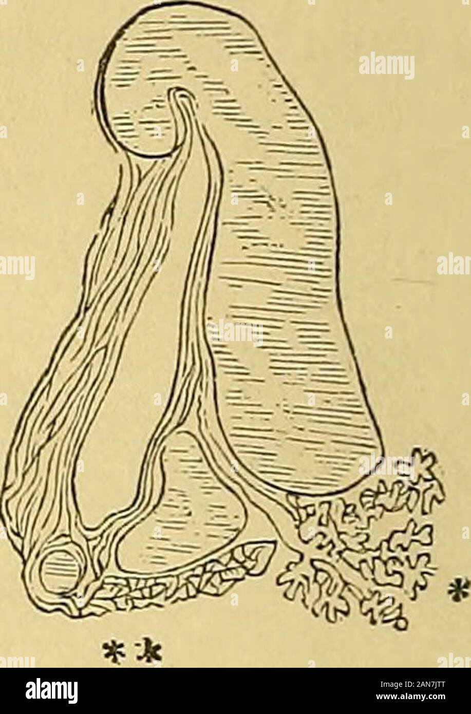 Cartilage tissue in the ear hi-res stock photography and images - Alamy