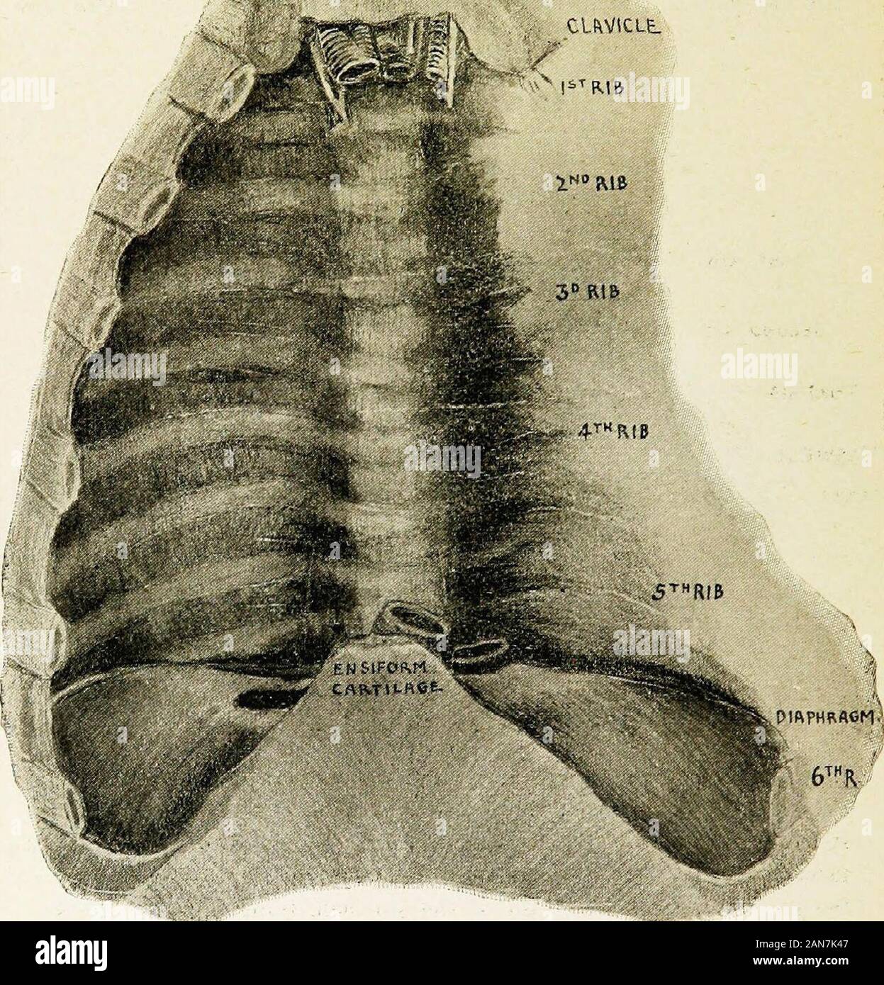 The signs of internal disease, with a brief consideration of the ...