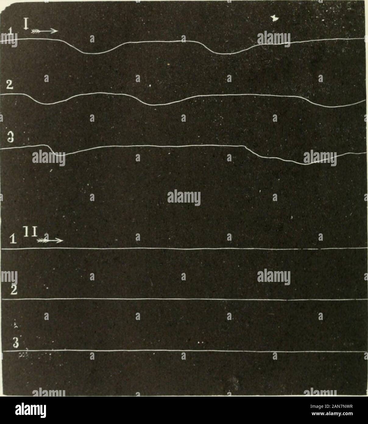 Cataleptic hi-res stock photography and images - Alamy