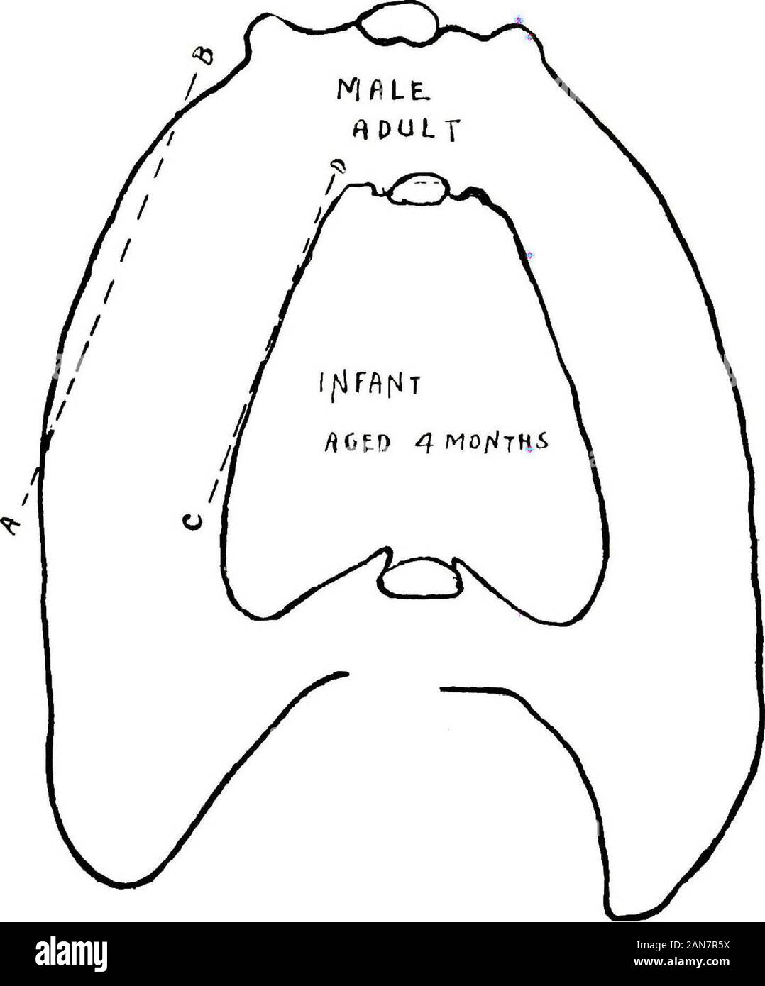 The signs of internal disease, with a brief consideration of the ...