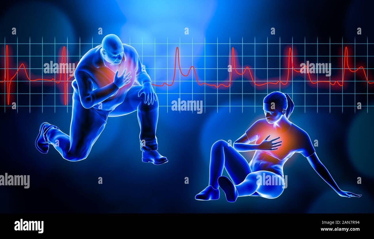 Obese of fat man kneeling while suffering from a heart attack 3d ...