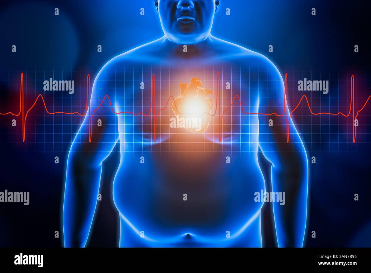 Fat or obese man chest body with heart and red ekg heartbeat curve ...