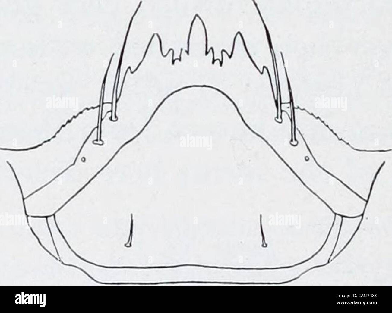 Vibrating Line Of Palate