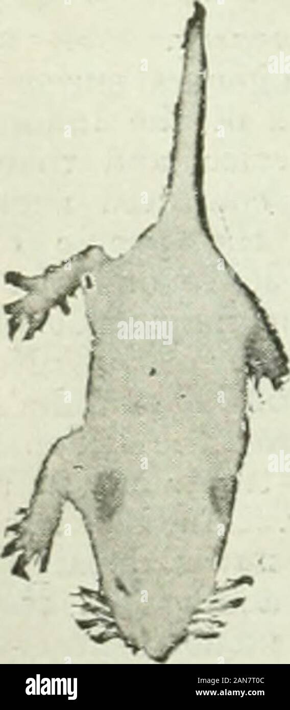 Cretinism hi-res stock photography and images - Alamy