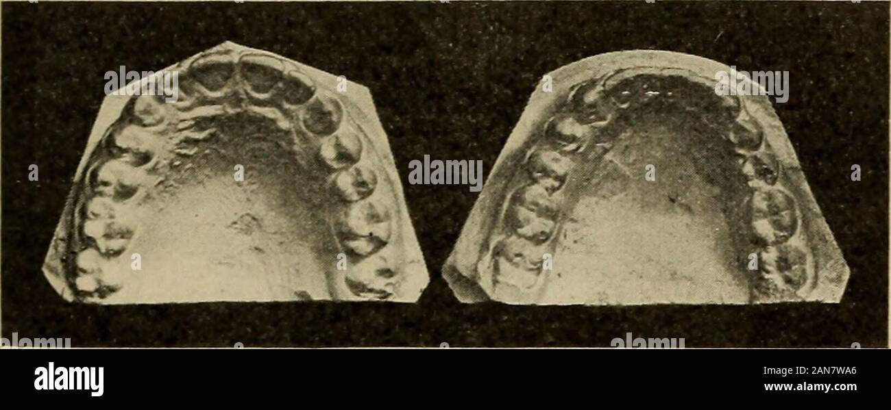 21 whole teeth hi-res stock photography and images - Alamy