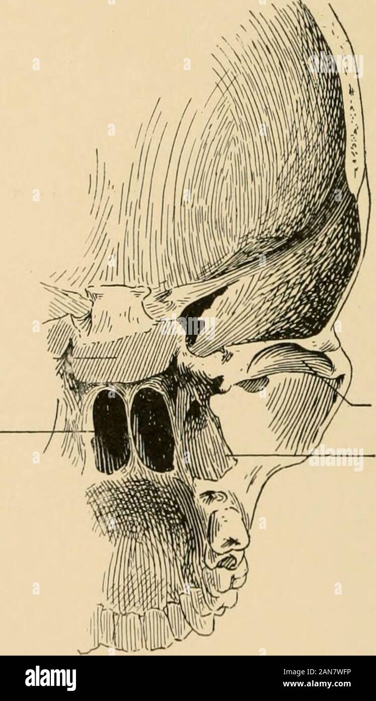 Inferior maxillary bone hi-res stock photography and images - Alamy