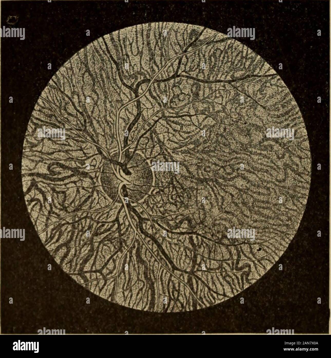 Text-book of ophthalmology . Temporal Fia. 26.—Tessellated Fundus. (For ...