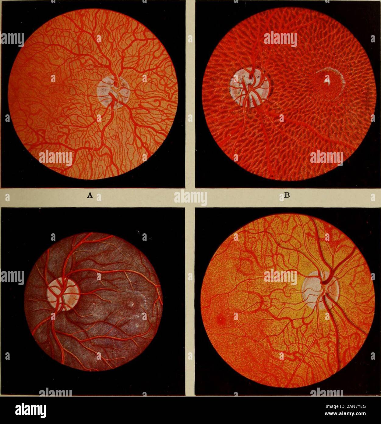 Text-book of ophthalmology . na vitrea lies thepigment epithelium. 9 ...