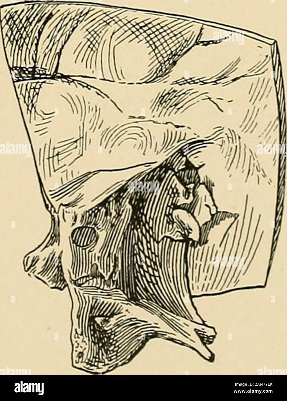 The treatment of fractures . Fig. 14. — Punctate fracture ...