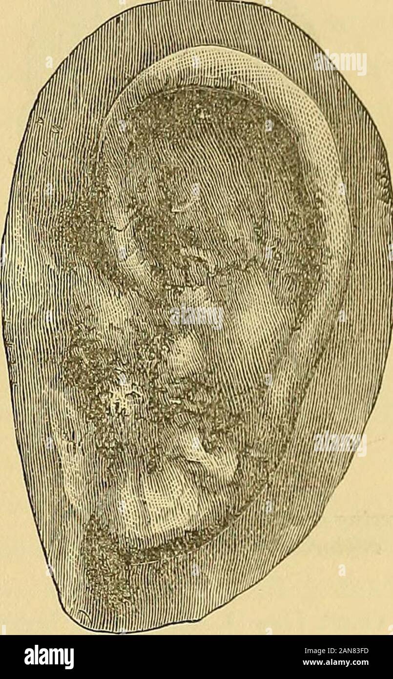 Othematoma hi-res stock photography and images - Alamy