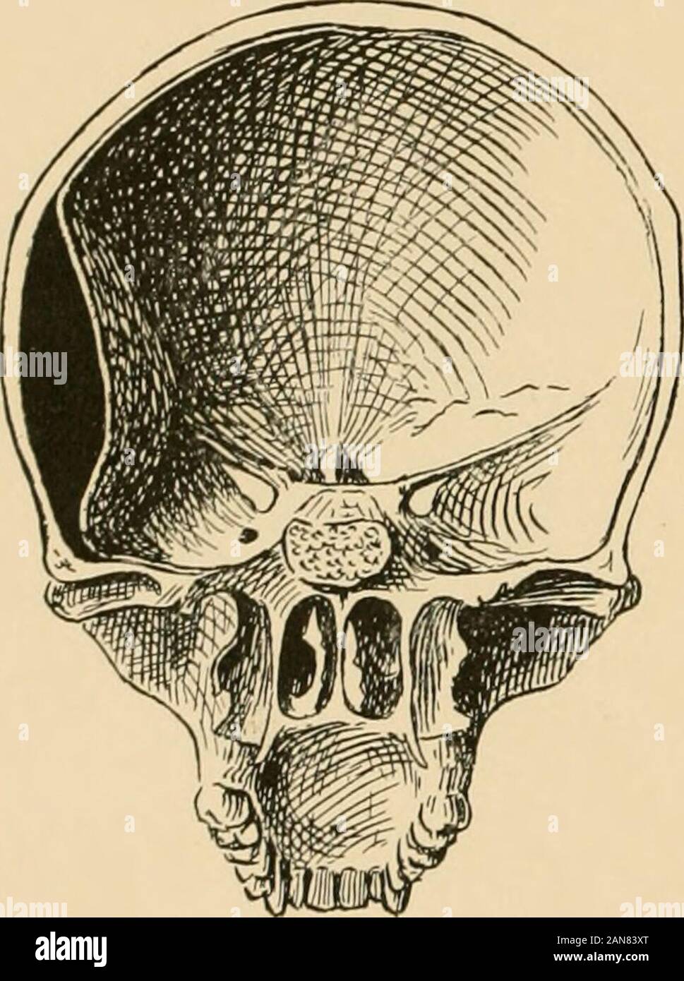 The treatment of fractures . andlaceration of the brain is continuous ...