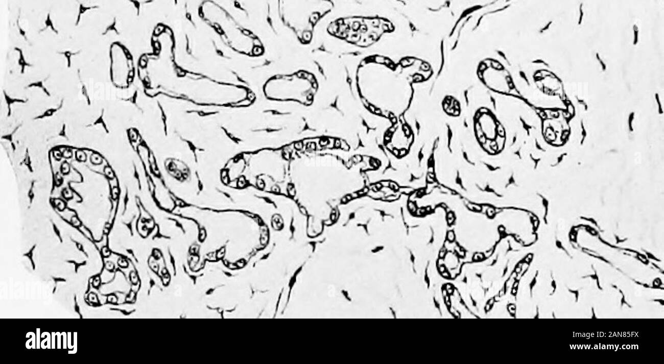 Small intestine walls Black and White Stock Photos & Images - Alamy