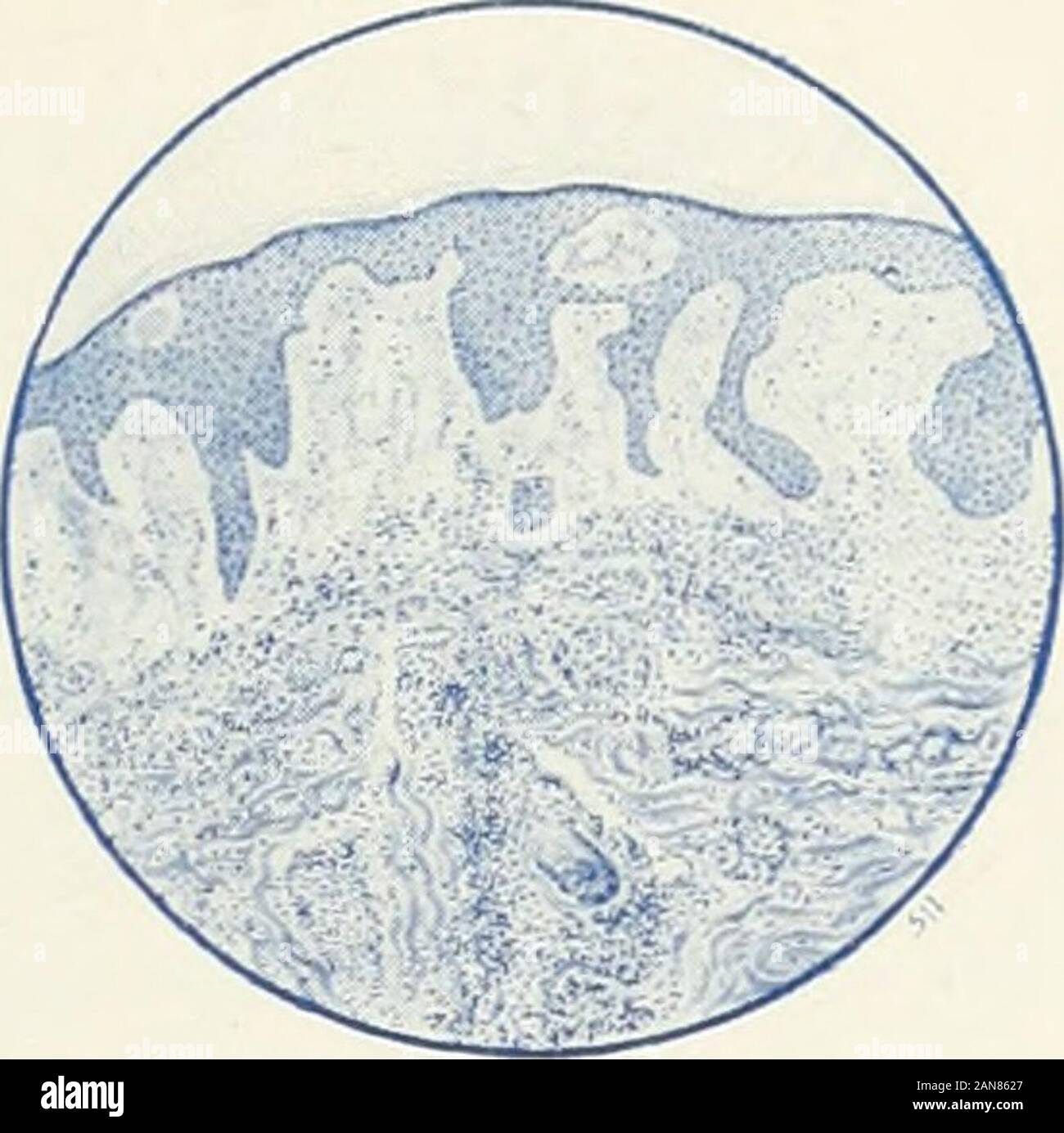 The British journal of dermatology . Fig. 5.—General view.. Fig. ti ...