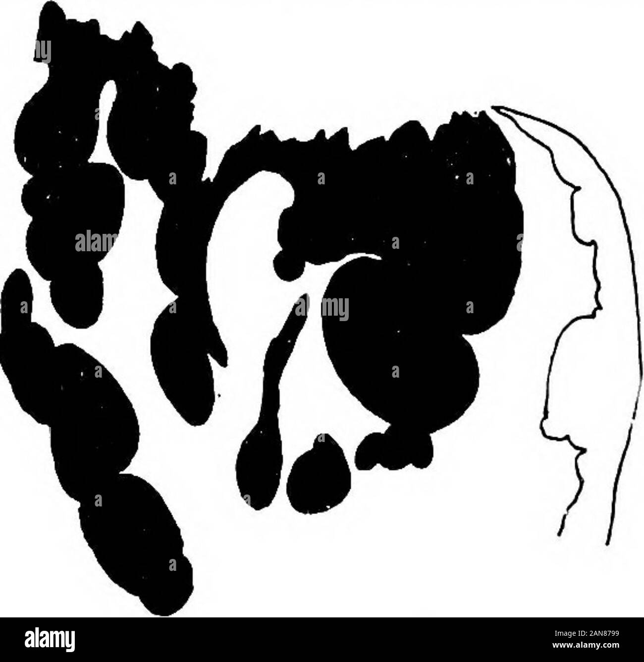 Human jaw cancer hi-res stock photography and images - Alamy