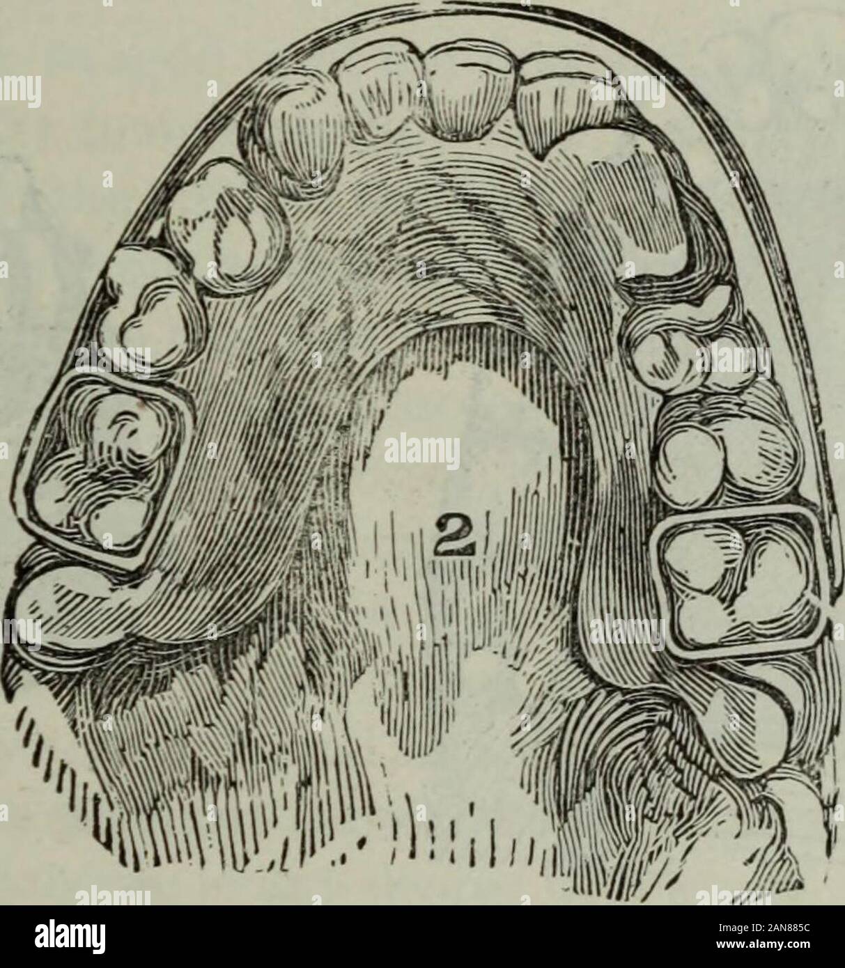 The Dental cosmos . constructed as to grasp over the crowns of the ...