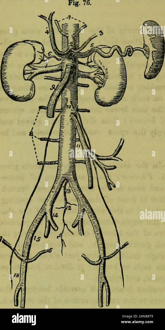 Splenic vein hi-res stock photography and images - Alamy
