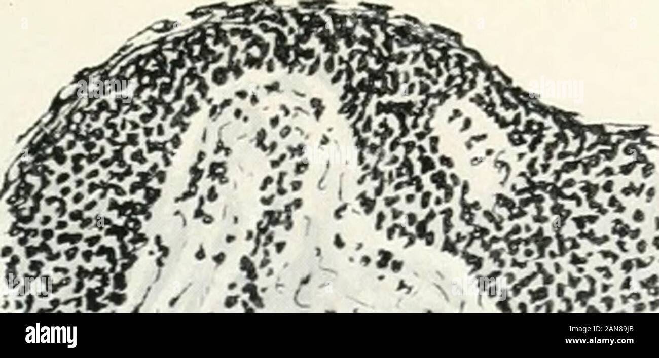 The British journal of dermatology . FiCt. 11.—a giant-cell at X (and ...