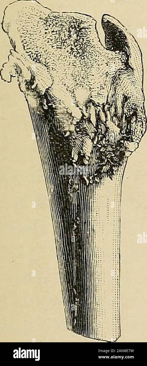 Hip disease in childhood : with special reference to its treatment by ...